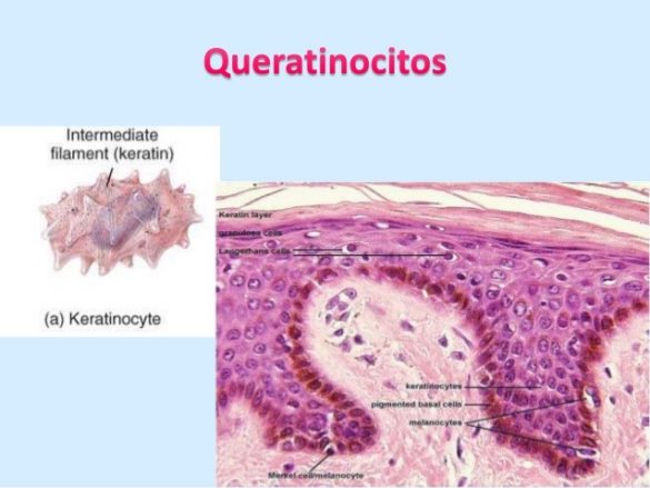 Dermatitis atópica, relación con la insuficiencia de filagrina