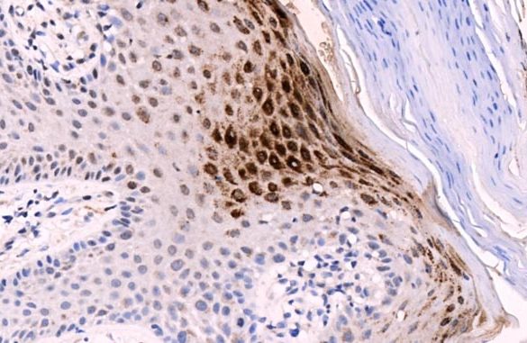 Filagrina, la proteína que proporciona la hidratación de la piel