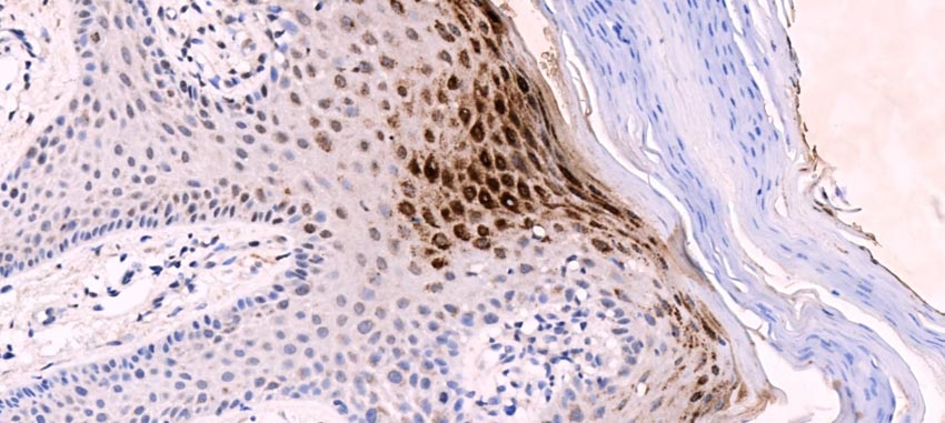 Filagrina, la proteína que proporciona la hidratación de la piel